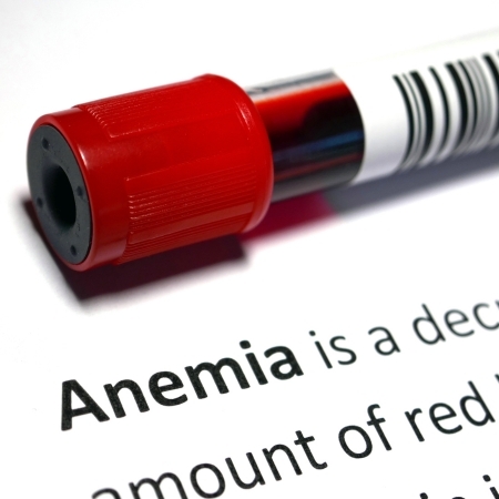 Лабораторний супровід диференціальної діагностики та лікування анемій - Evopro.pro